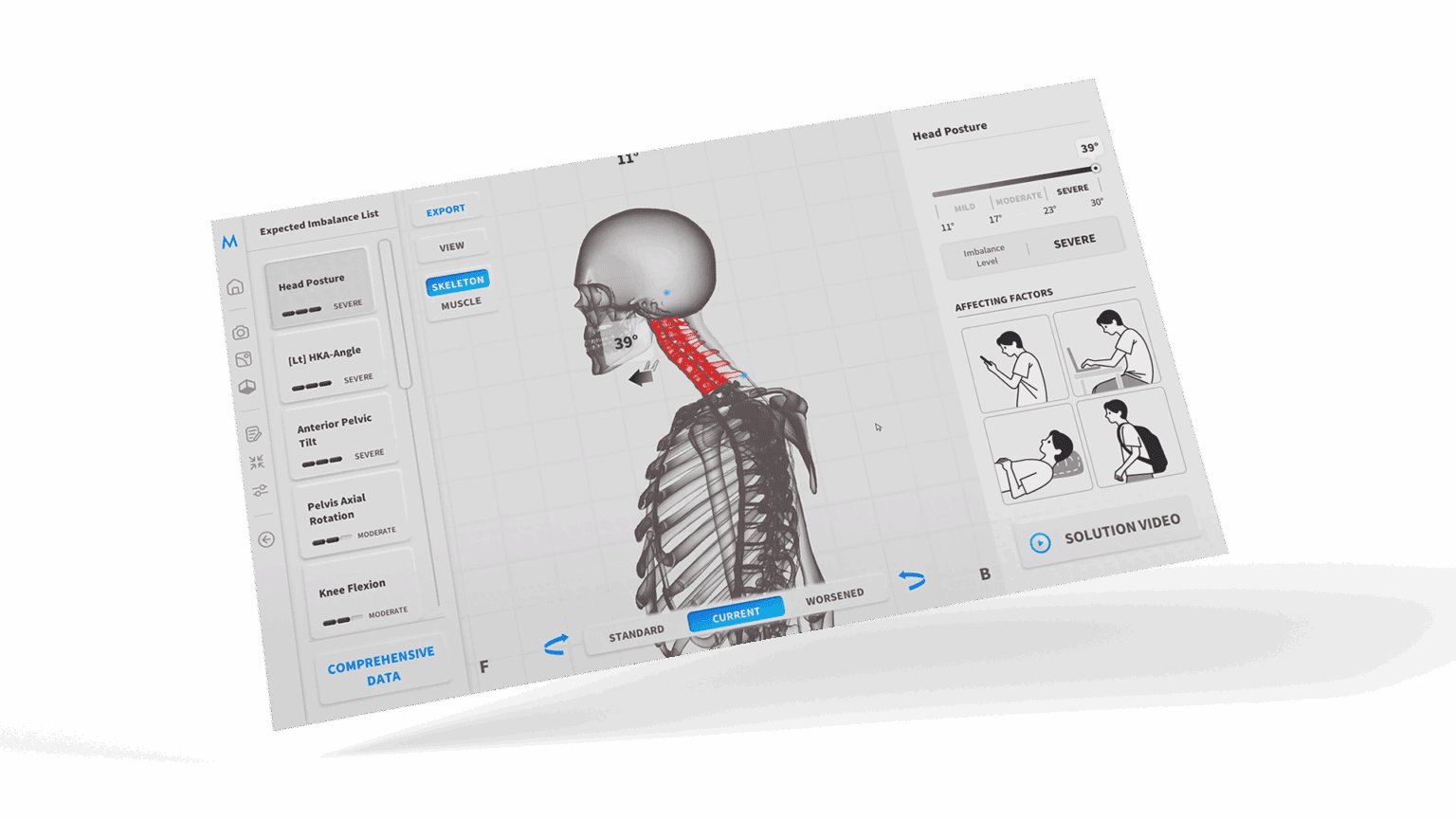 Ai Postural Evaluation - ACS Therapy, Inc
